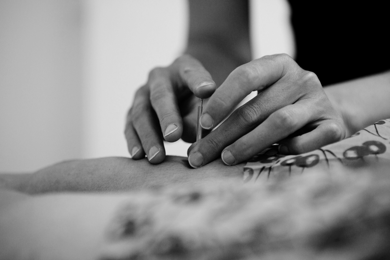 How to prepare for your first acupuncture appointment - KATY BRADSHAW ...